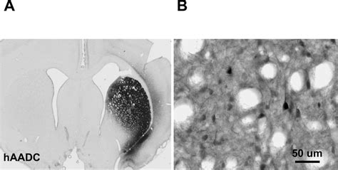 The Efficacy Of Striatal Transduction Post Aav2 Haadc Injection A