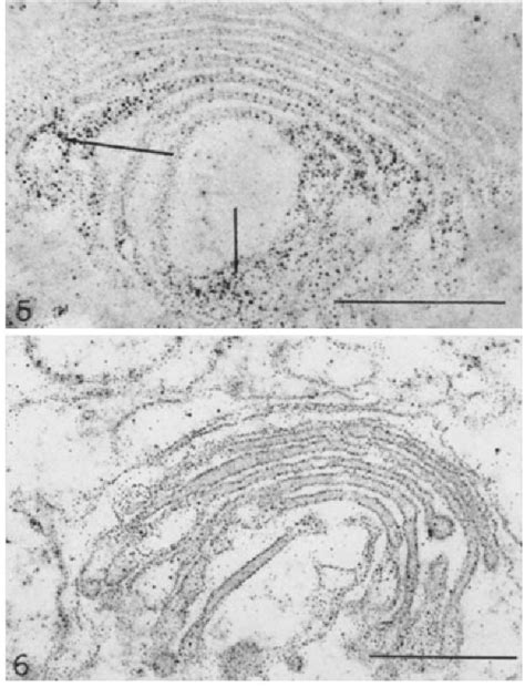 Figure 5 From Cytochemical Staining Of The Golgi Apparatus In Amoeba