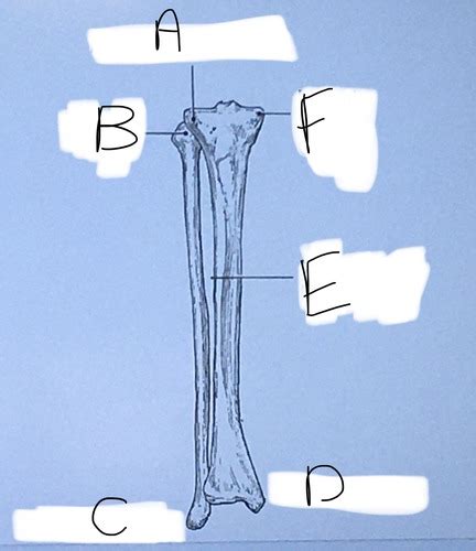 Tibia And Fibula Labeling Flashcards Quizlet