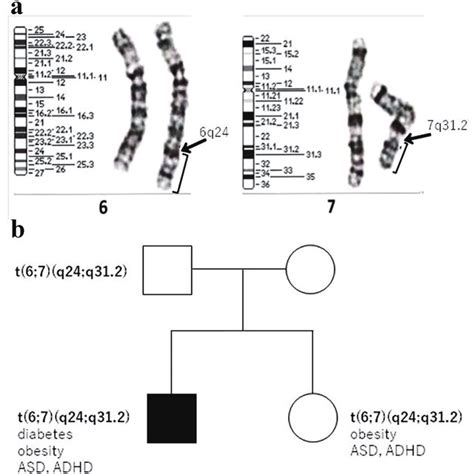 A Cytogenetic Analysis Showing A Balanced Reciprocal Translocation