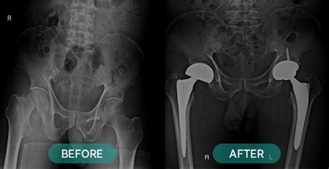 상계바론정형외과