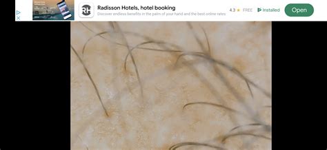 Microscope Comparison Of Hairs R Tressless