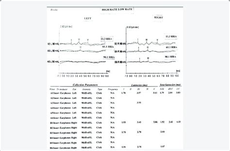 Represents High Rate Low Rate Abr Test Results Showing Poor Waveform Download Scientific