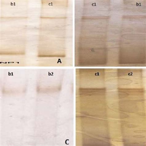 Band Patterns Revealed By Single Strand Conformation Polymorphism Download Scientific Diagram