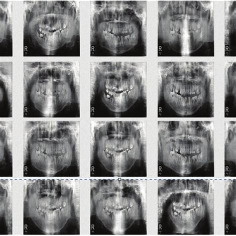 Sample Of Generated Images After 500 Epochs Download Scientific Diagram
