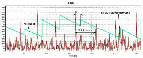 Ecg Thresholding And Noise Detection Download Scientific Diagram