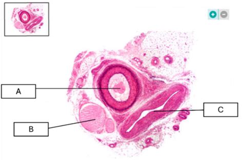 Bio 139 Lab Anatomy Of The Heart Flashcards Quizlet