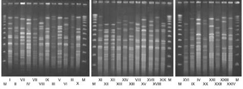 Table 1 From Characterisation Of Pasteurella Multocida Isolated From Rabbits In The Czech