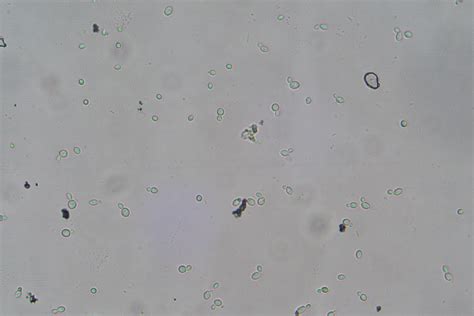 Detecting Circularelliptical Shape With Python Opencv Or Any Other Lib Stack Overflow