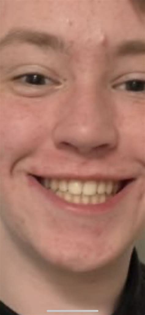 Liam Downing On Twitter Stoolfootball This Is The Average Am Rican Trying To Talk About