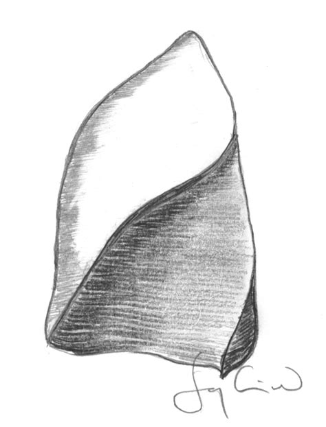 4 Diffuse Swelling Diffuse Involvement Of The Lower Lobe Of Left Lung Download Scientific