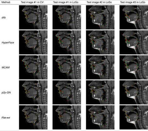 Automatic Vocal Tract Landmark Localization From Midsagittal Mri Data Scientific Reports
