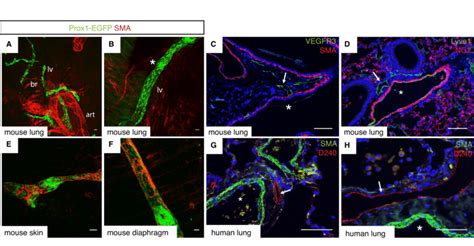 Pulmonary Collecting Lymphatics Lack Smooth Muscle Cell Or Pericyte