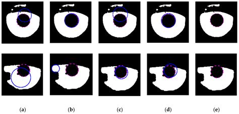 Robust Iris Segmentation Algorithm In Non Cooperative Environments Using Interleaved Residual U Net