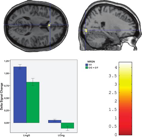 Cortical Activation During Face Encoding Top Row Brain Images