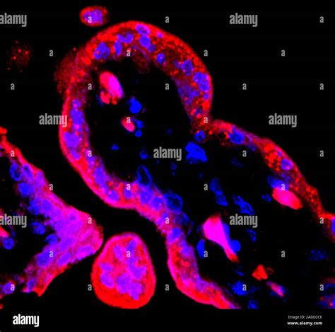 Trophoblasts Fluorescence Deconvolution Micrograph Of Trophoblast