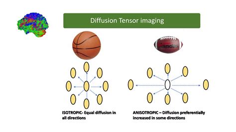 Diffusion Tensor Imaging In Evaluation Of Epilepsy Pptpptx