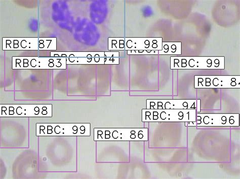 Rcnn Fast Rcnn And Faster Rcnn Algorithms For Object Detection Explained Amir Masoud