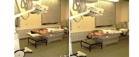 Positioning Of The Patient And X Ray Projection In Neutral Position A Download Scientific
