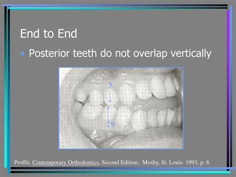Ppt Occlusion Powerpoint Presentation Free Download Id 6736052