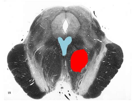 Midbrain At The Level Of The Superior Colliculus And Red Nucleus Diagram Quizlet