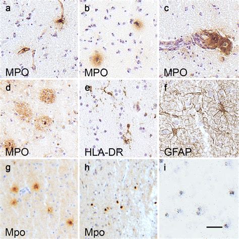 Typical Cellular Localization Of Myeloperoxidase Mpo Expression In Download Scientific