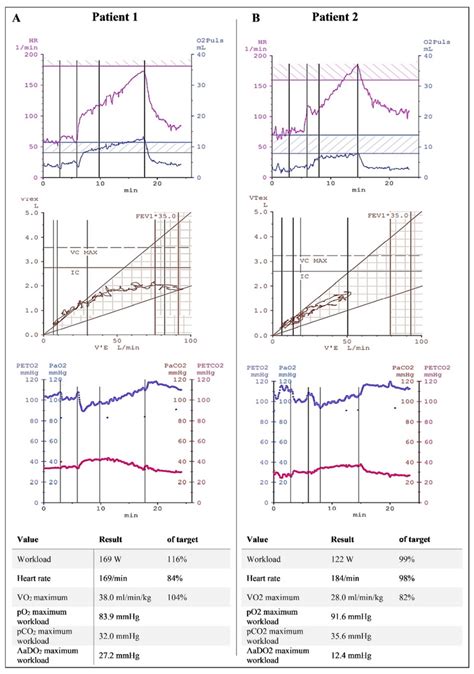 Cardiopulmonary Exercise Testing Of A Patient With No Limitation A