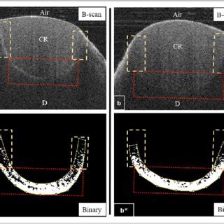 Representative CP OCT Images For SG A And NSG B Groups A The Download Scientific Diagram
