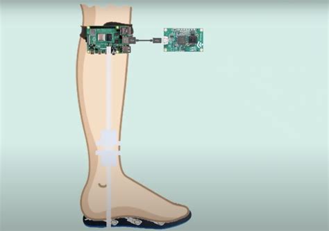 Foot Pressure Sensors Detect Parkinsons Disease Raspberry Pi