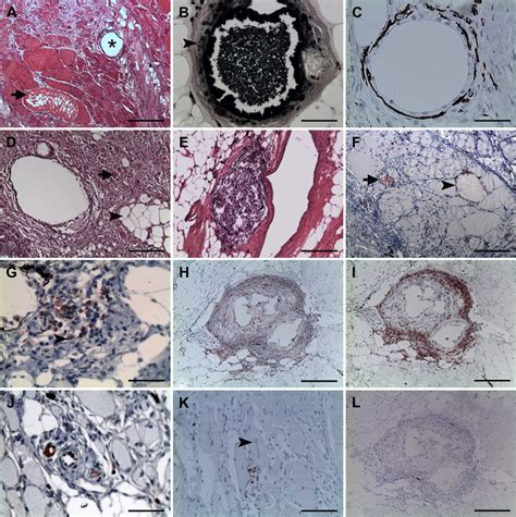 Histopathological Investigations Of Formalin Fixed Paraffin Embedded