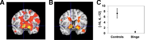 Reward Prediction Error Signals A C RPE Signal Encoding In The