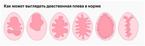 Дефлорация что это всегда ли бывает кровь будет ли больно при первом