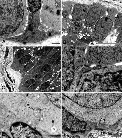 Tem Of Scs From Pre Pubertal Human Testicular Tissue Fresh A