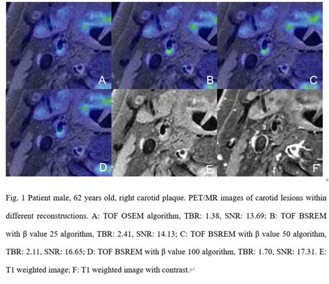 Quantitative Performance And Optimal Regularization Parameter In Block Sequential Regularized