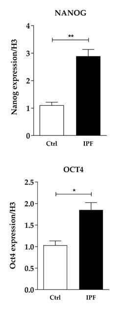 In Vitro Characterization Of Ipf Primary Cell Line A Primary Culture