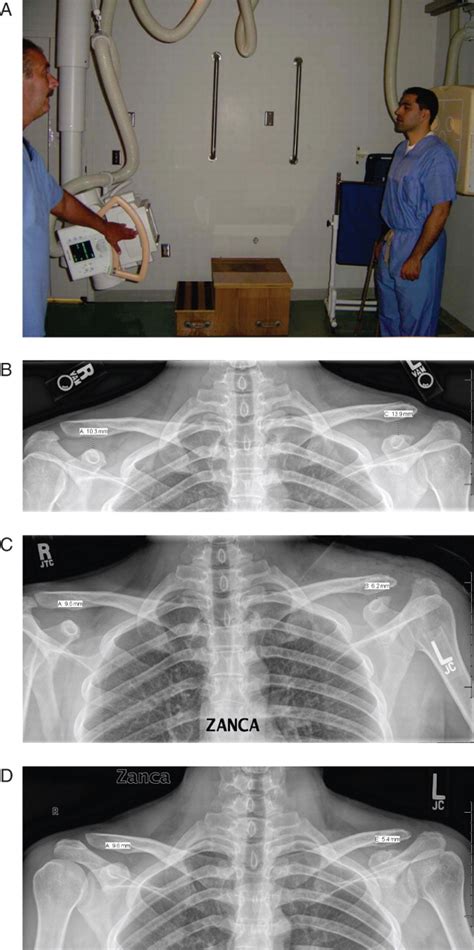 Zanca View Chest X Ray At Amy Curley Blog