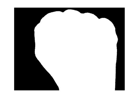 Matlabhow To Eleiminate The Black Background And Retain The Region Of Interest In My Image