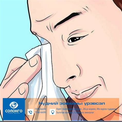 Солонго Нүдний Эмнэлэг Зовхины ирмэг үрэвсэх нь олон шалтгаантай Үүнд 1 Бие махбодын харшил