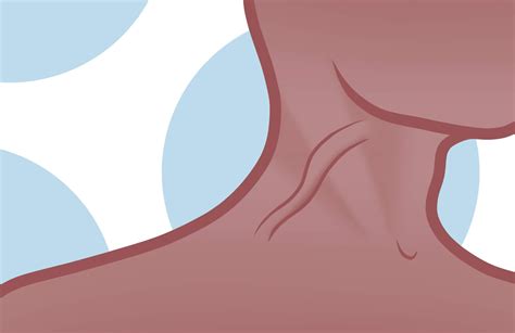 Location Of Jugular Vein Neck