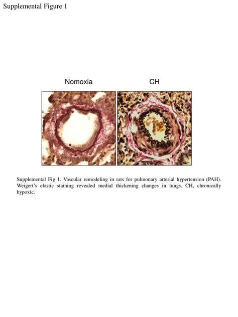 PPT Supplemental Figure PowerPoint Presentation Free Download ID