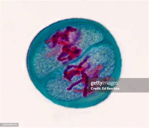 Metaphase Photos And Premium High Res Pictures Getty Images