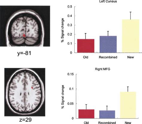 Brain Regions Showing Both Old