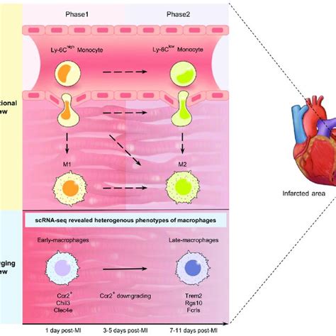 Traditional And Emerging Concepts Of Monocytes Macrophages In Infarcted Download Scientific