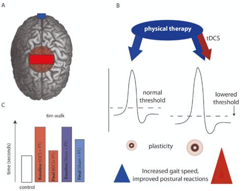 The Electric Brain Novel Treatments For Neurological Gait And Balance