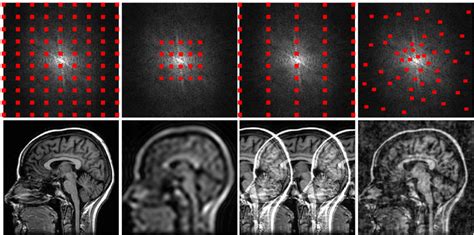 Figure 14 From Efficient Compressed Sensing Reconstruction Frameworks