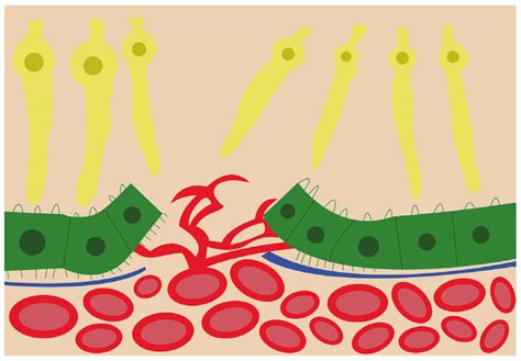 Schematic View Of The Choroidal Neovascularization Process The New