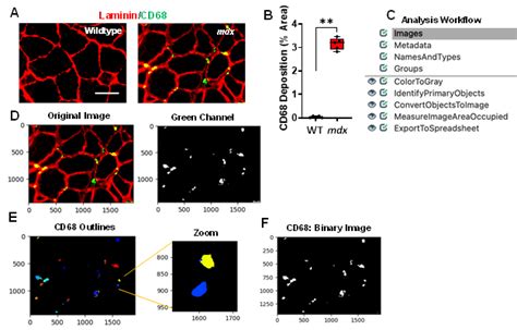 automated image analysis pipeline development to monitor disease