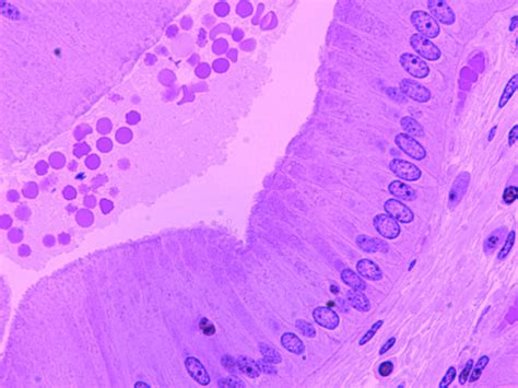 The Function Of Simple Columnar Tissue At Grace Brentnall Blog