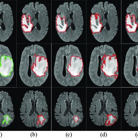 Segmentation And Corresponding Comparison Of Synthetic And Real Images Download Scientific