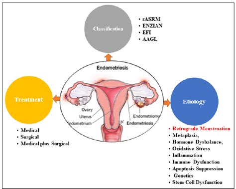 A Primer On Clinical Classification And Pathophysiology Of Endometriosis Fertility Science And